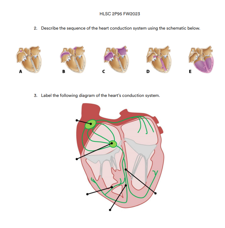 Solved Describe the sequence of the heart conduction system | Chegg.com