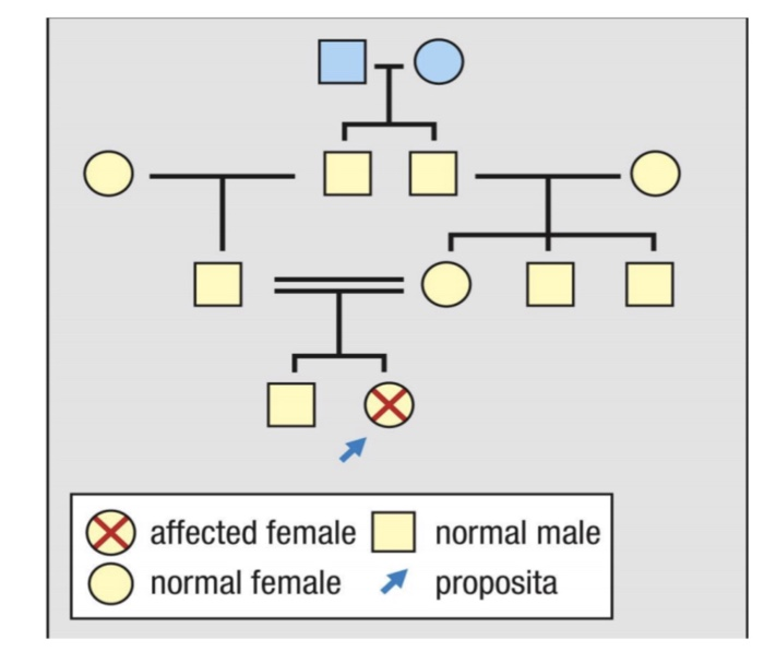Solved Pedigree of a family with AID deficiency. The parents | Chegg.com