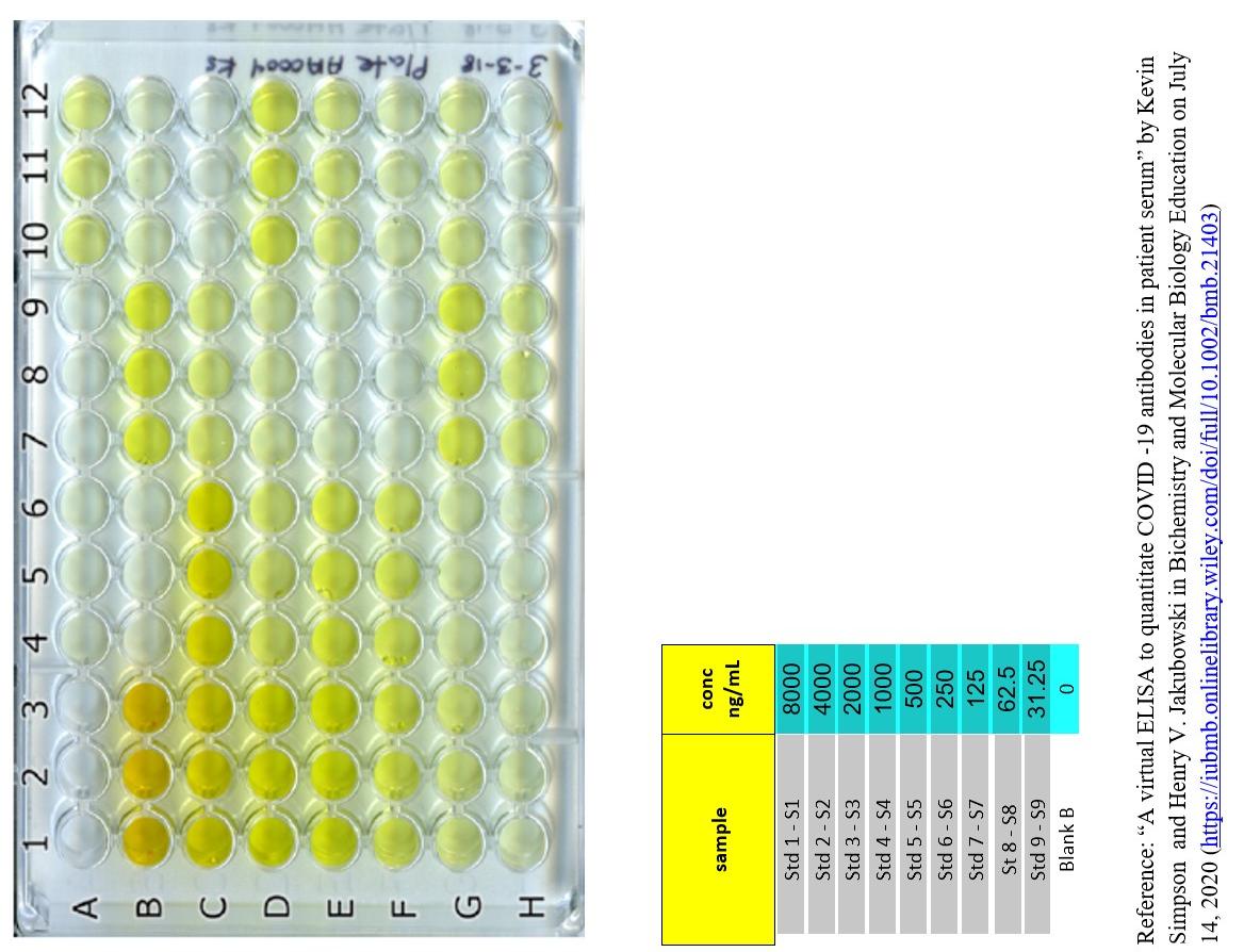 Below is the data from a (mock) SARS-CoV2 antibody | Chegg.com