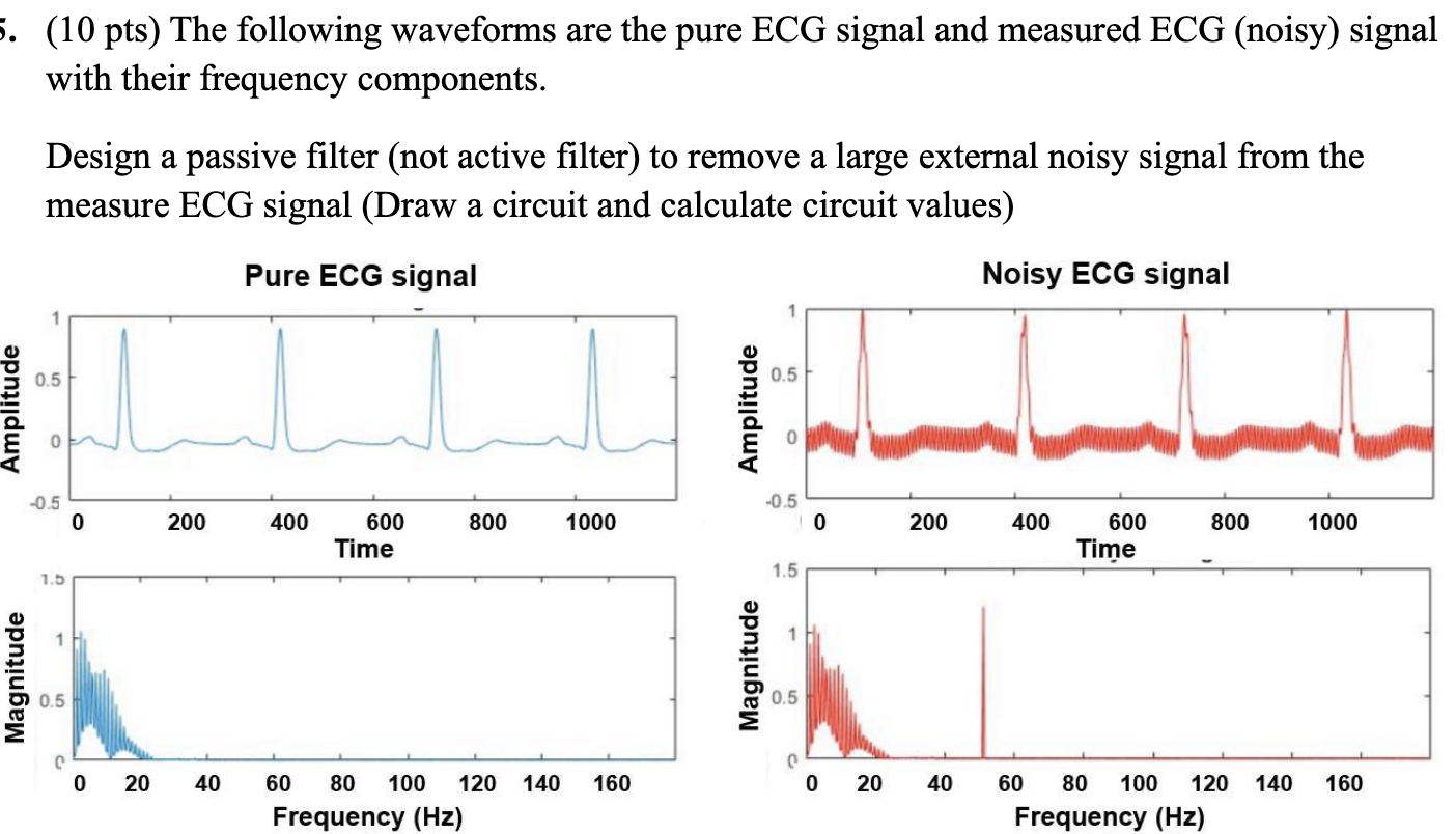 Solved 5. (10 pts) The following waveforms are the pure ECG | Chegg.com