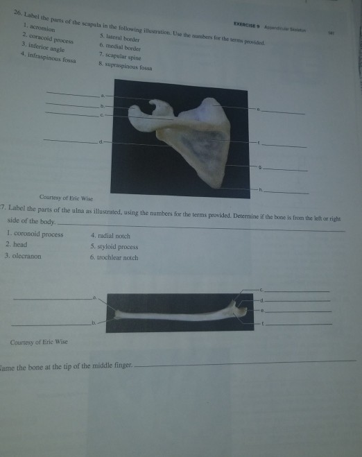 Solved EXERCISE Asperr 26. Label the parts of the scapula in | Chegg.com