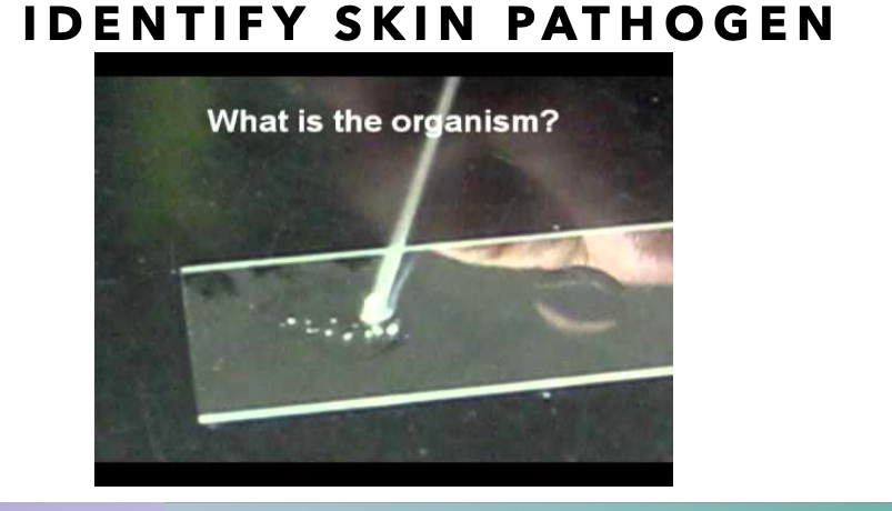 Solved IDENTIFY SKIN PATHOGEN What is the organism? | Chegg.com