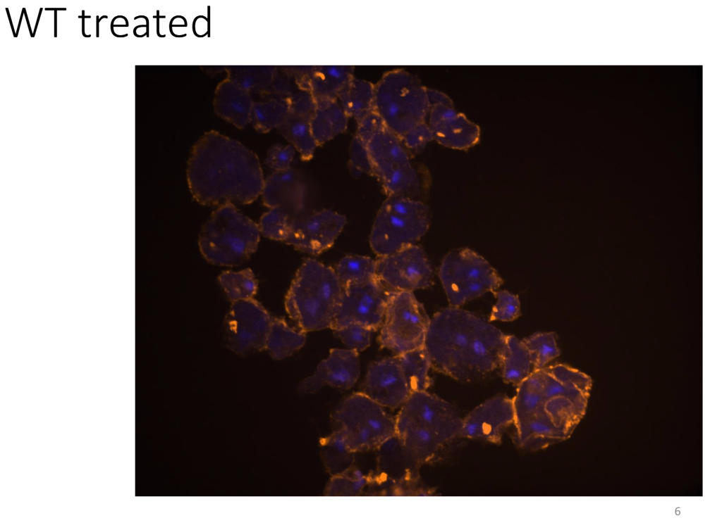 Solved Following is the picture showing actin and DAPI | Chegg.com