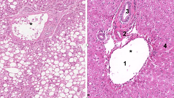 Solved The slide here is of the portal triad in the liver, | Chegg.com