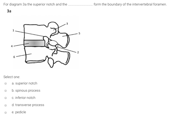 Solved For diagram 3a the superior notch and the | Chegg.com