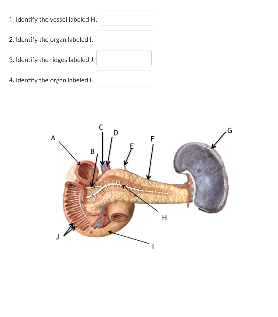 Solved 1. ﻿Identify the vessel labeled H . 2. ﻿Identify the | Chegg.com