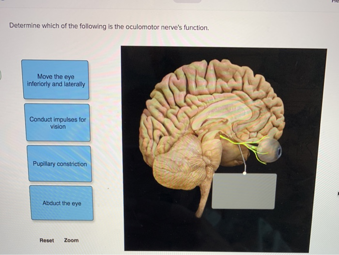 Solved Determine which of the following is the oculomotor | Chegg.com