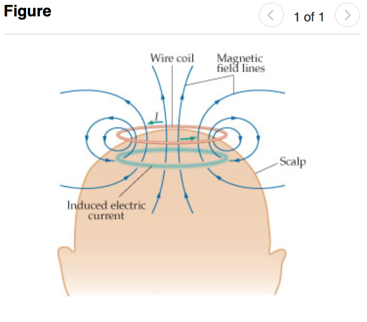 Solved BIO Transcranial Magnetic Stimulation Transcranial | Chegg.com