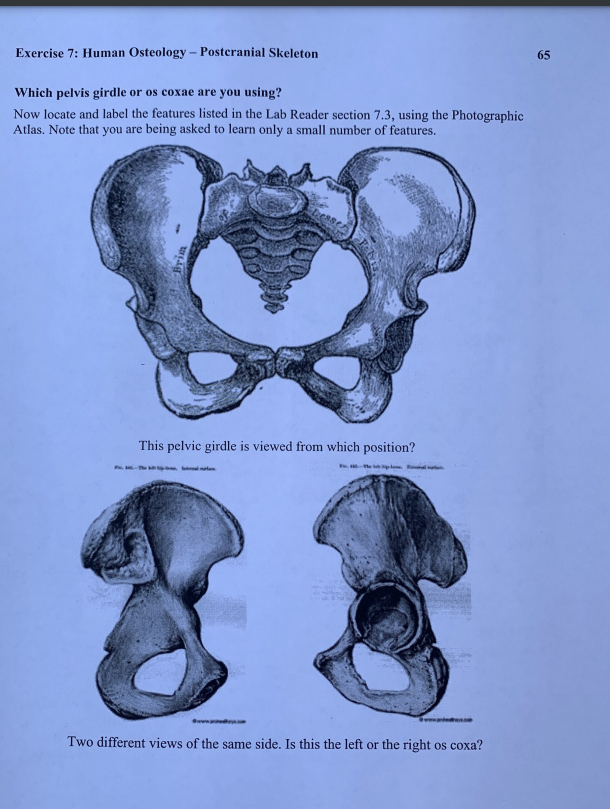 Solved Exercise 7: Human Osteology - Postcranial Skeleton | Chegg.com
