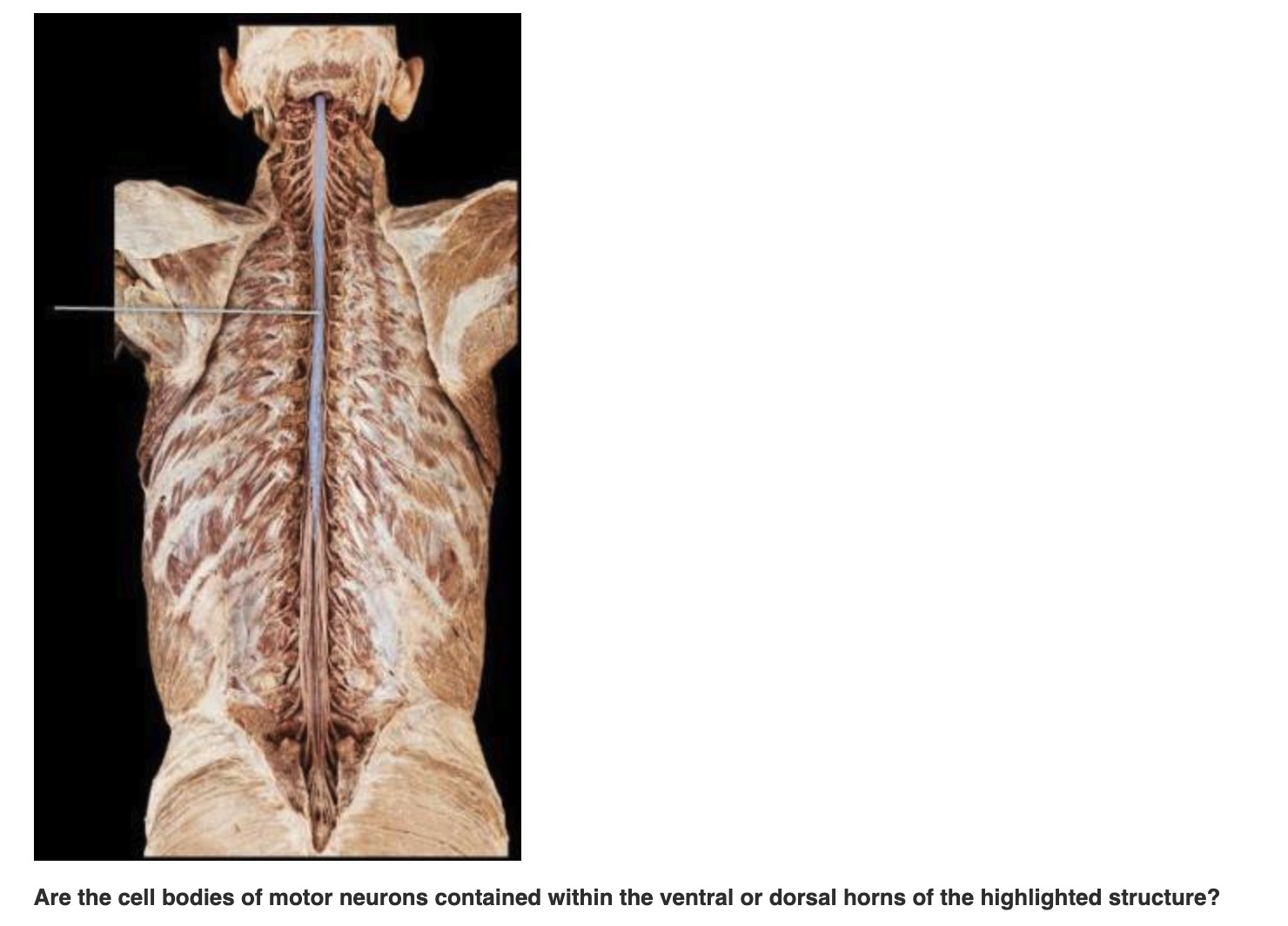 Solved Are the cell bodies of motor neurons contained within | Chegg.com