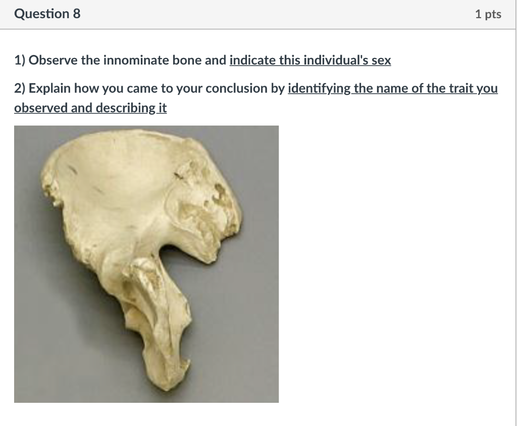 Solved Question 8 1 pts 1) Observe the innominate bone and | Chegg.com