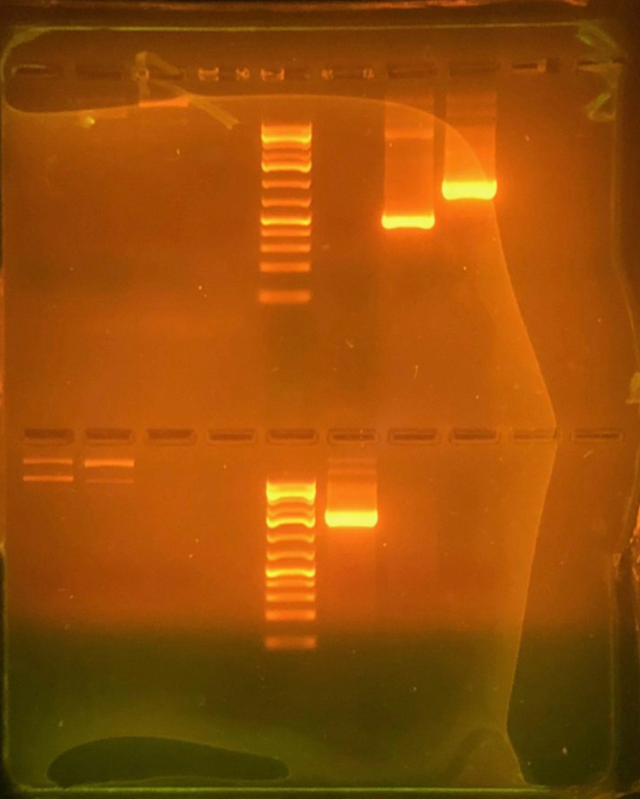 Solved Annotate and Analyze gel The info given: Load | Chegg.com