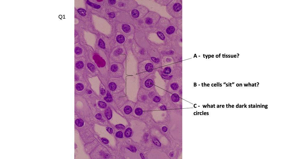 Solved Q1 A - type of tissue? B - the cells "sit" on what? C | Chegg.com
