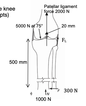 Solved Consider stability of the knee joint in the frontal | Chegg.com