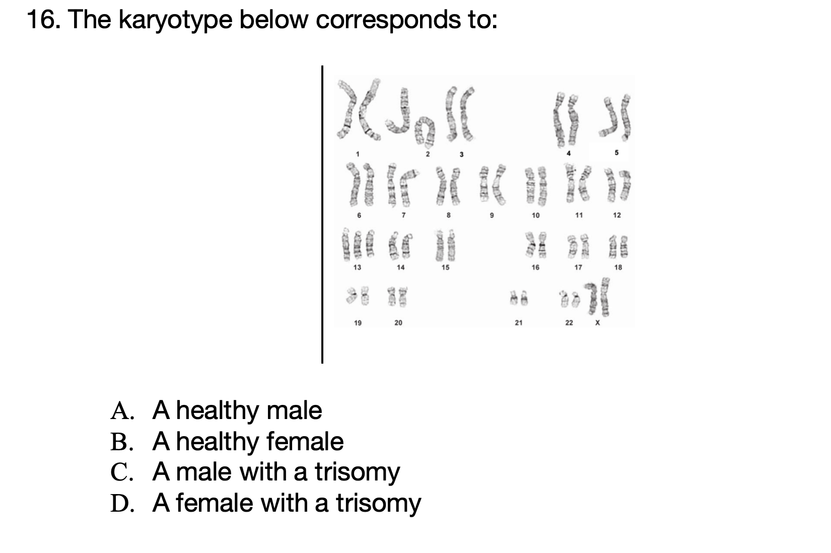 Solved The karyotype below corresponds to:A. ﻿A healthy | Chegg.com