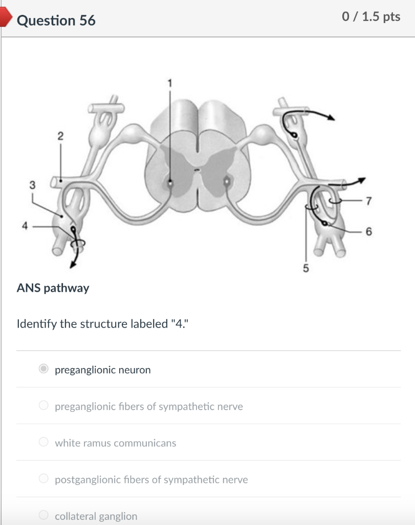 Solved Question 56 0 / 1.5 pts 2 3 7 4 6 ANS pathway | Chegg.com
