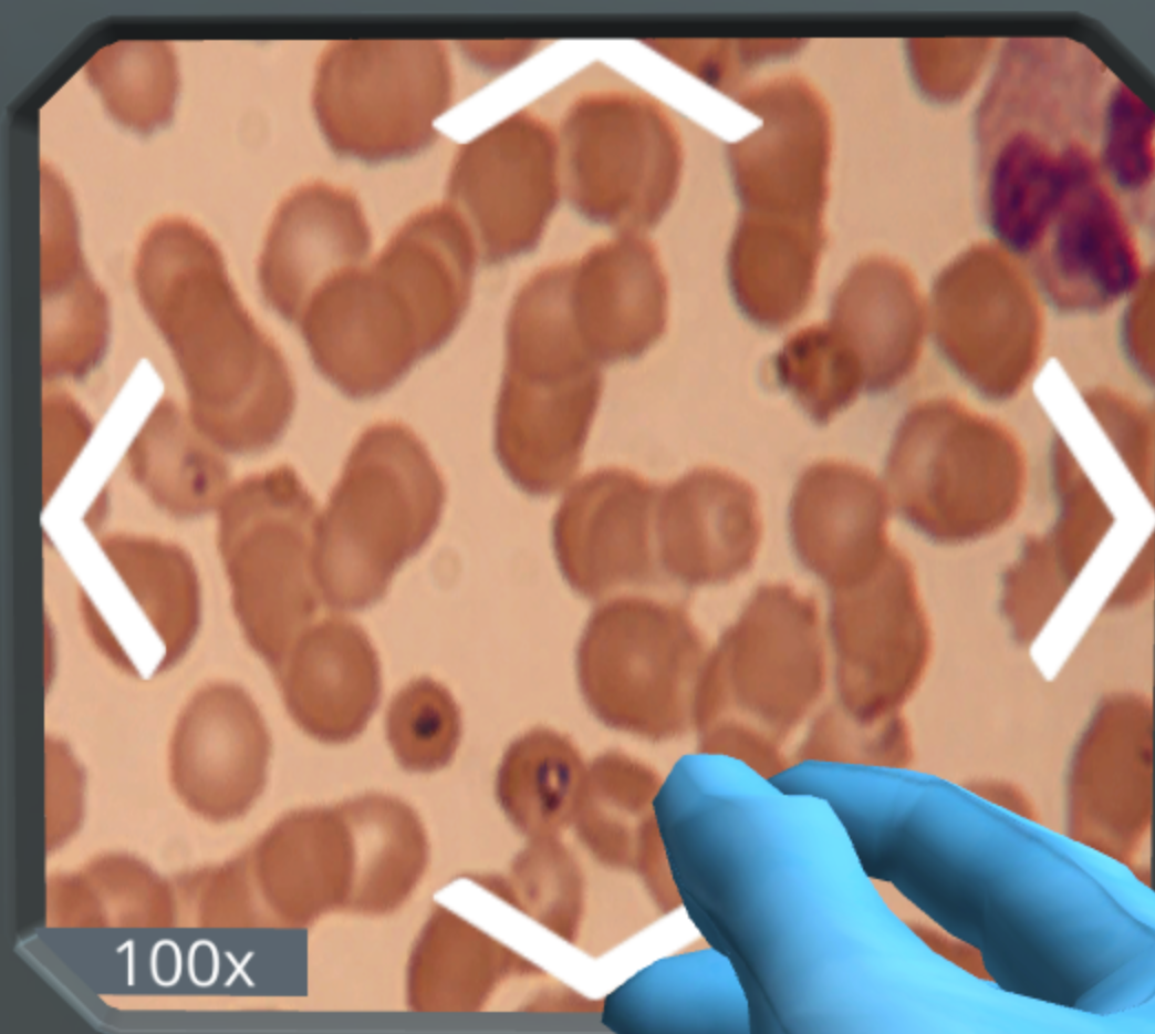 Solved 100x 100x 100x What can you detect in the blood | Chegg.com