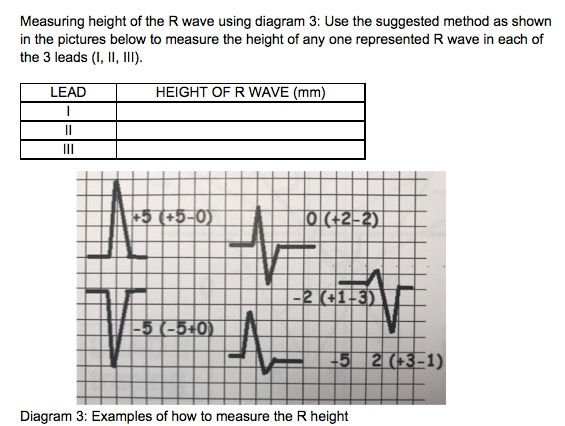 Solved Measuring height of the R wave using diagram 3: Use | Chegg.com
