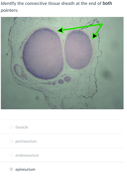 Solved Identify the connective tissue sheath at the end of | Chegg.com