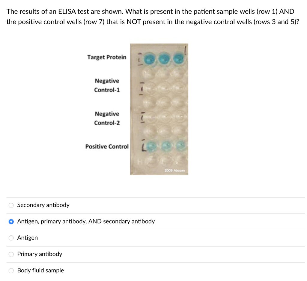 Solved The results of an ELISA test are shown. What is | Chegg.com