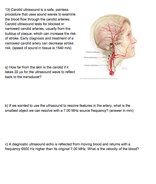 Solved 13) Carotid ultrasound is a safe, painless procedure | Chegg.com