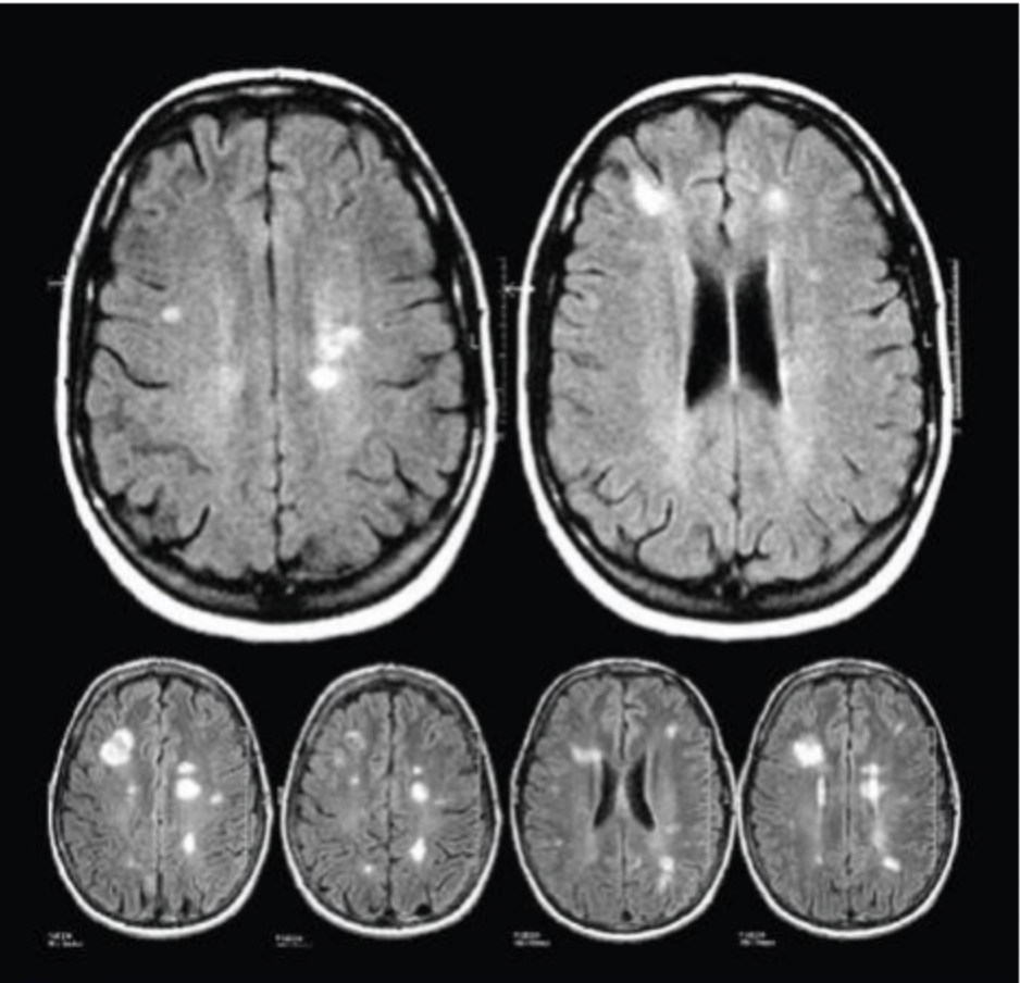 Solved In the illustration below, multiple ‘slices’ of a | Chegg.com