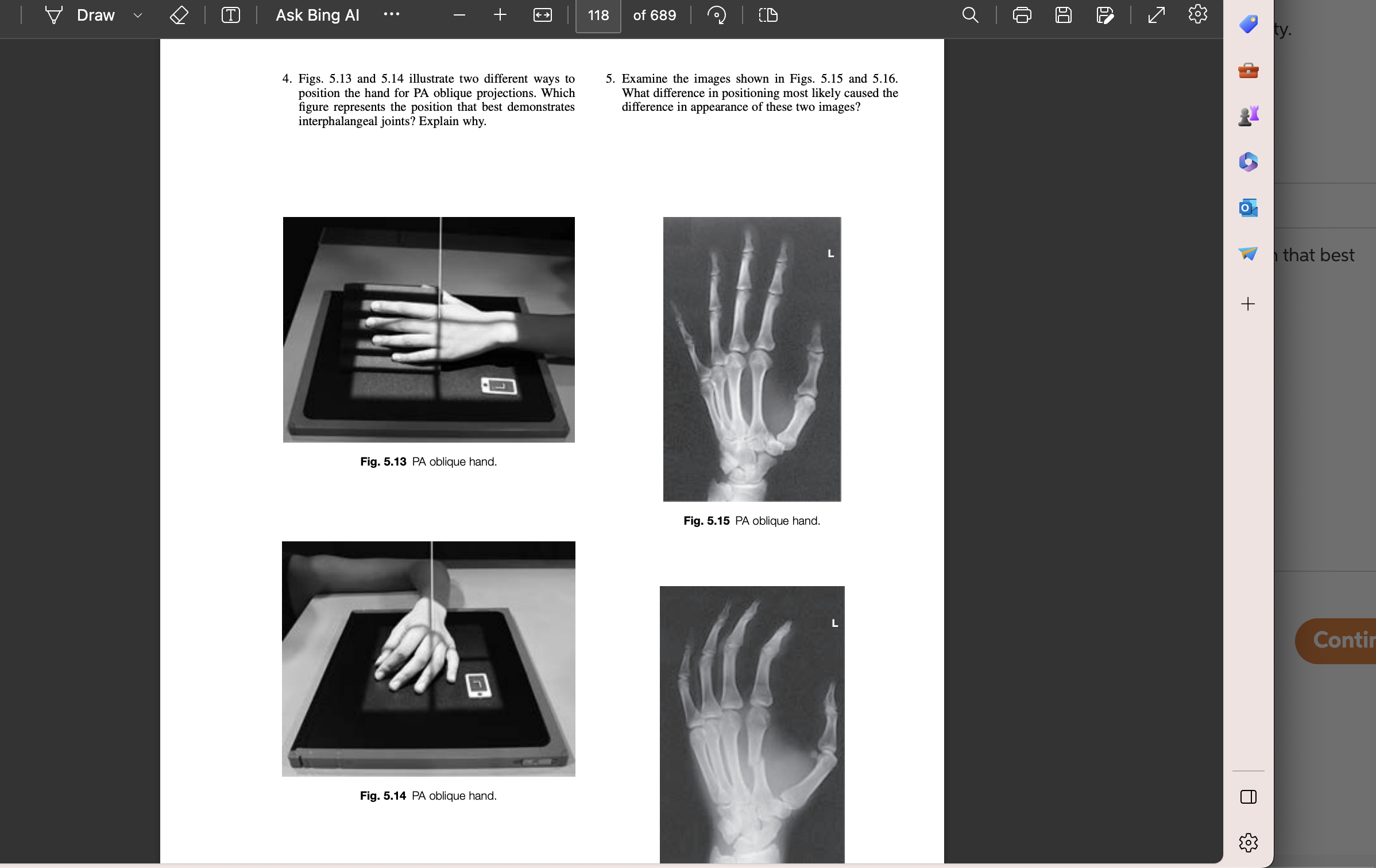 4. Figs. 5.13 and 5.14 illustrate two different ways | Chegg.com