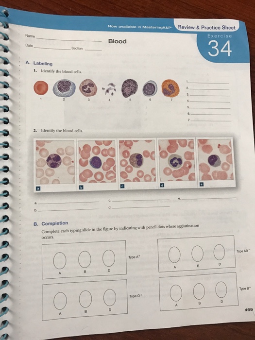 Solved A. Labeling 1. Identify the blood cells. 2. | Chegg.com