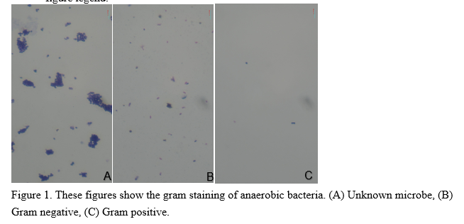 Solved Describe the quality of each of your control Gram | Chegg.com