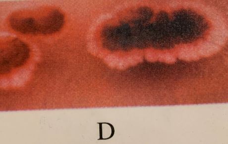 Solved The bacterial growth pattern on agar slant Tube D is | Chegg.com