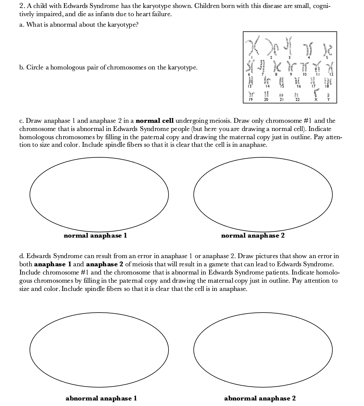 Solved 2. A child with Edwards Syndrome has the karyotype | Chegg.com