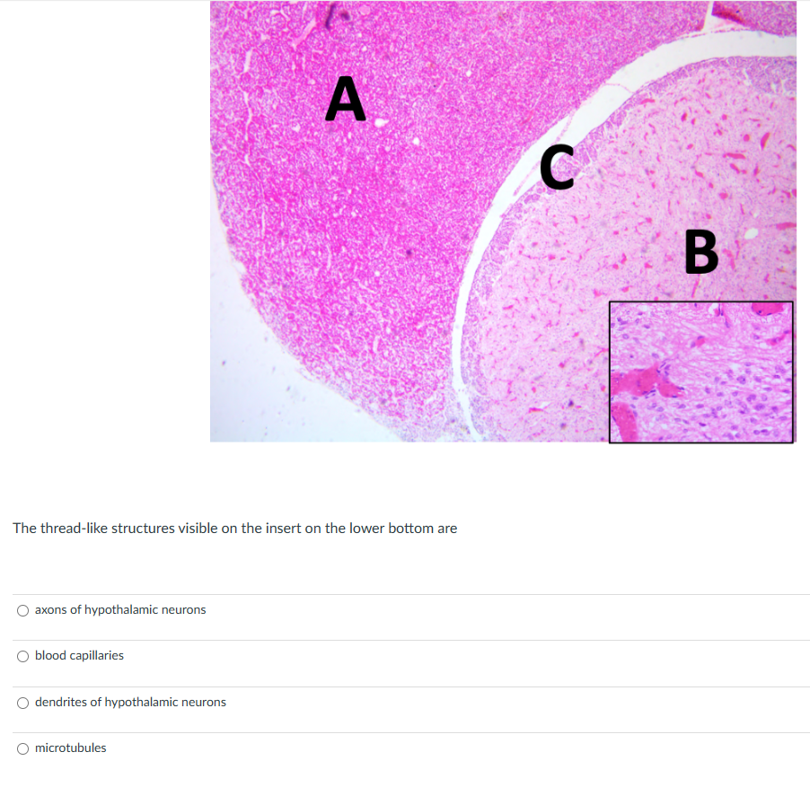 Solved The thread-like structures visible on the | Chegg.com