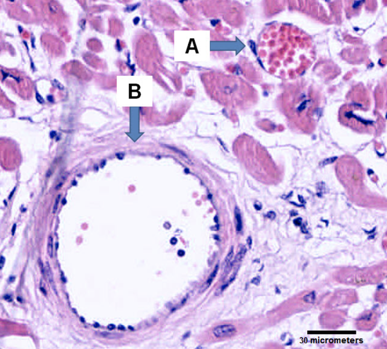 Solved READ THE DIRECTIONS Two blood vessels are indicated | Chegg.com