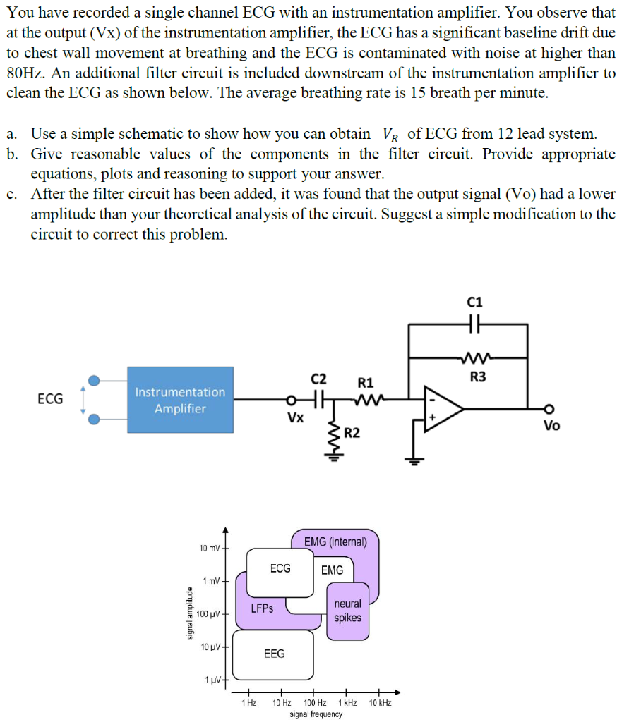 Solved You have recorded a single channel ECG with an | Chegg.com