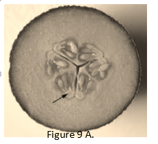 Solved Identify the ovary wall, ovules, locules in the given | Chegg.com