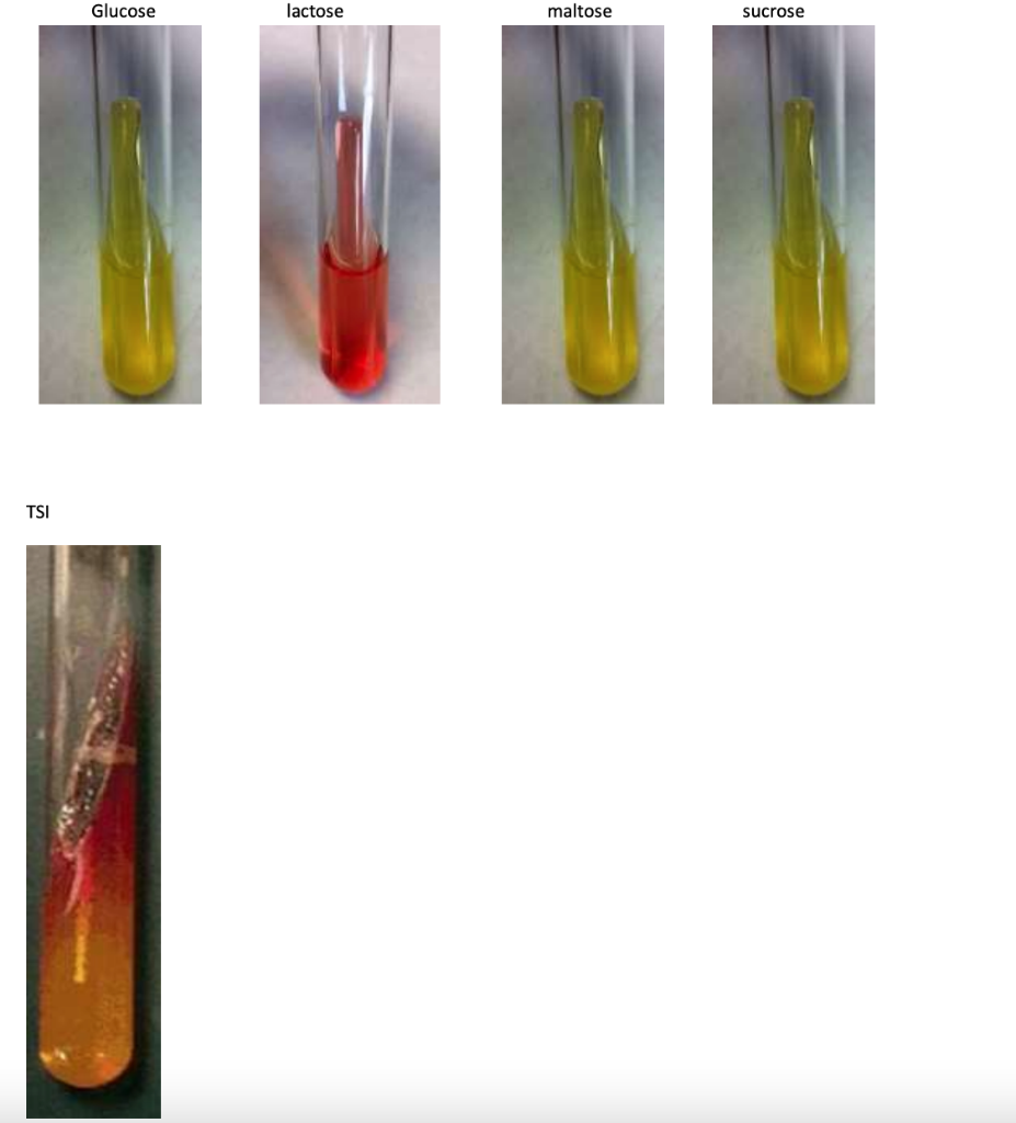 Solved SIM test Glucose TSI MacConkey plate ( growth) EMB | Chegg.com