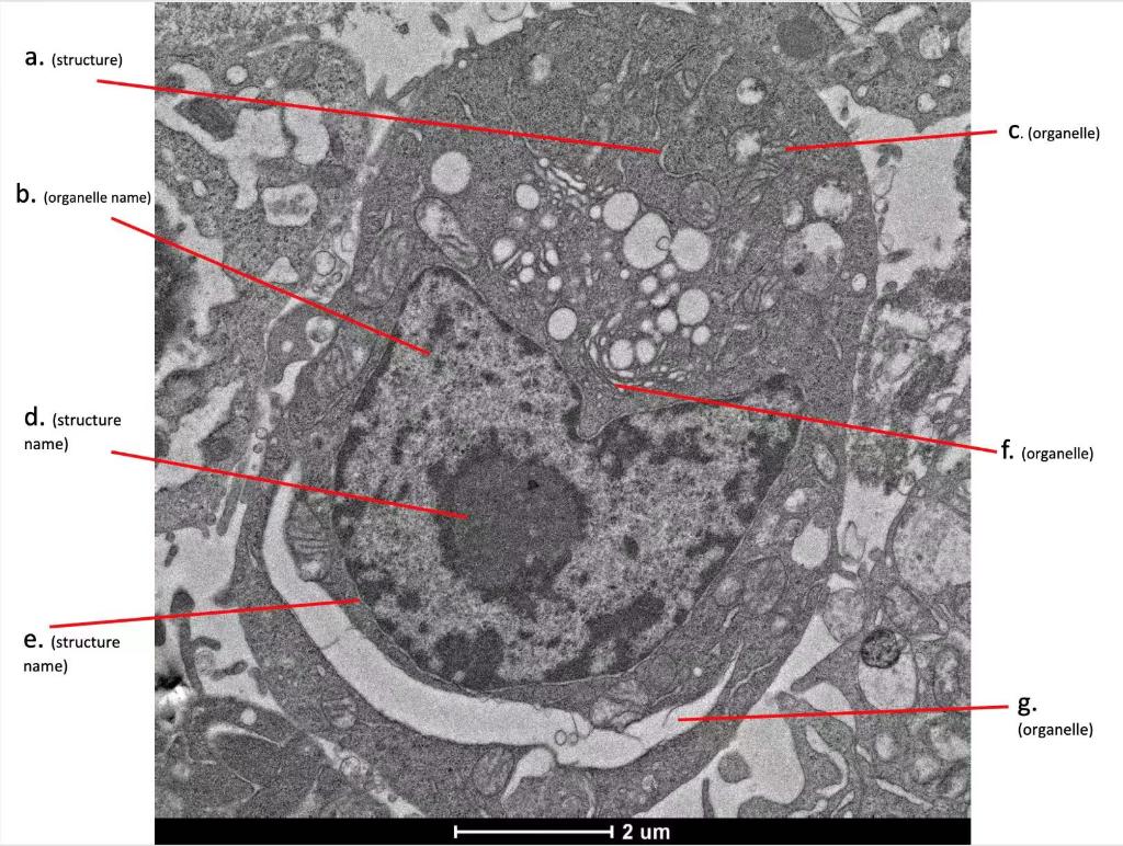 Mystery cells Features in the mystery cells are | Chegg.com