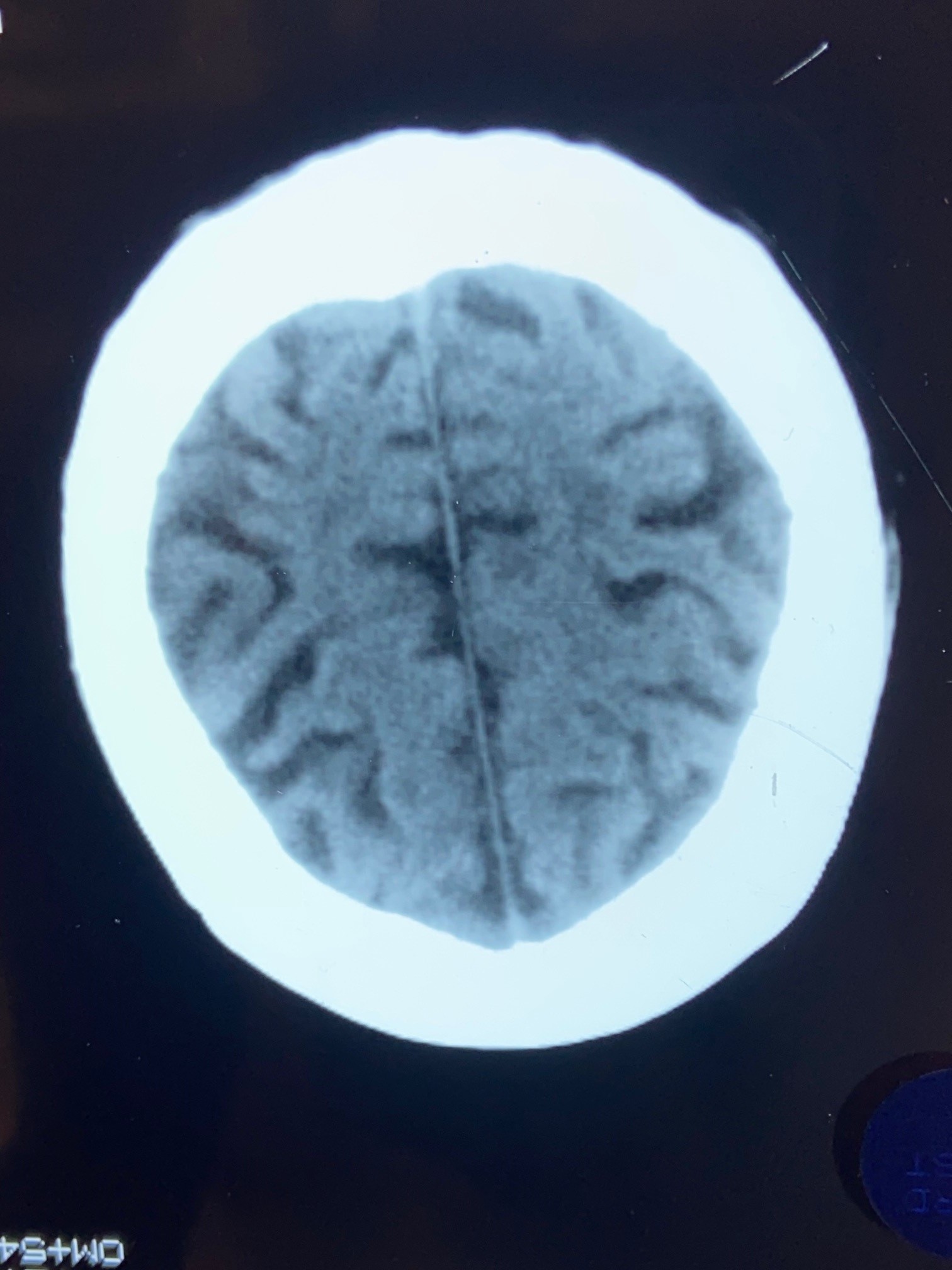 Solved In medical imaging, the moustache sign identifies the | Chegg.com