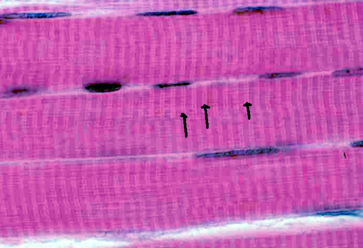 Which part of this muscle tissue are the yellow | Chegg.com