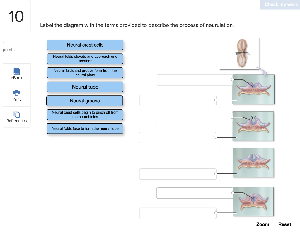 Solved Check my work 10 Label the diagram with the terms | Chegg.com Solved Check my work 10 Label the diagram with the terms | Chegg.com