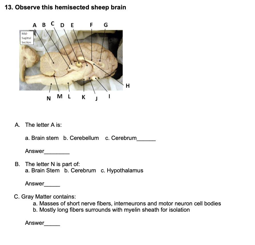 Solved 13. Observe this hemisected sheep brain A B C D E F G | Chegg.com