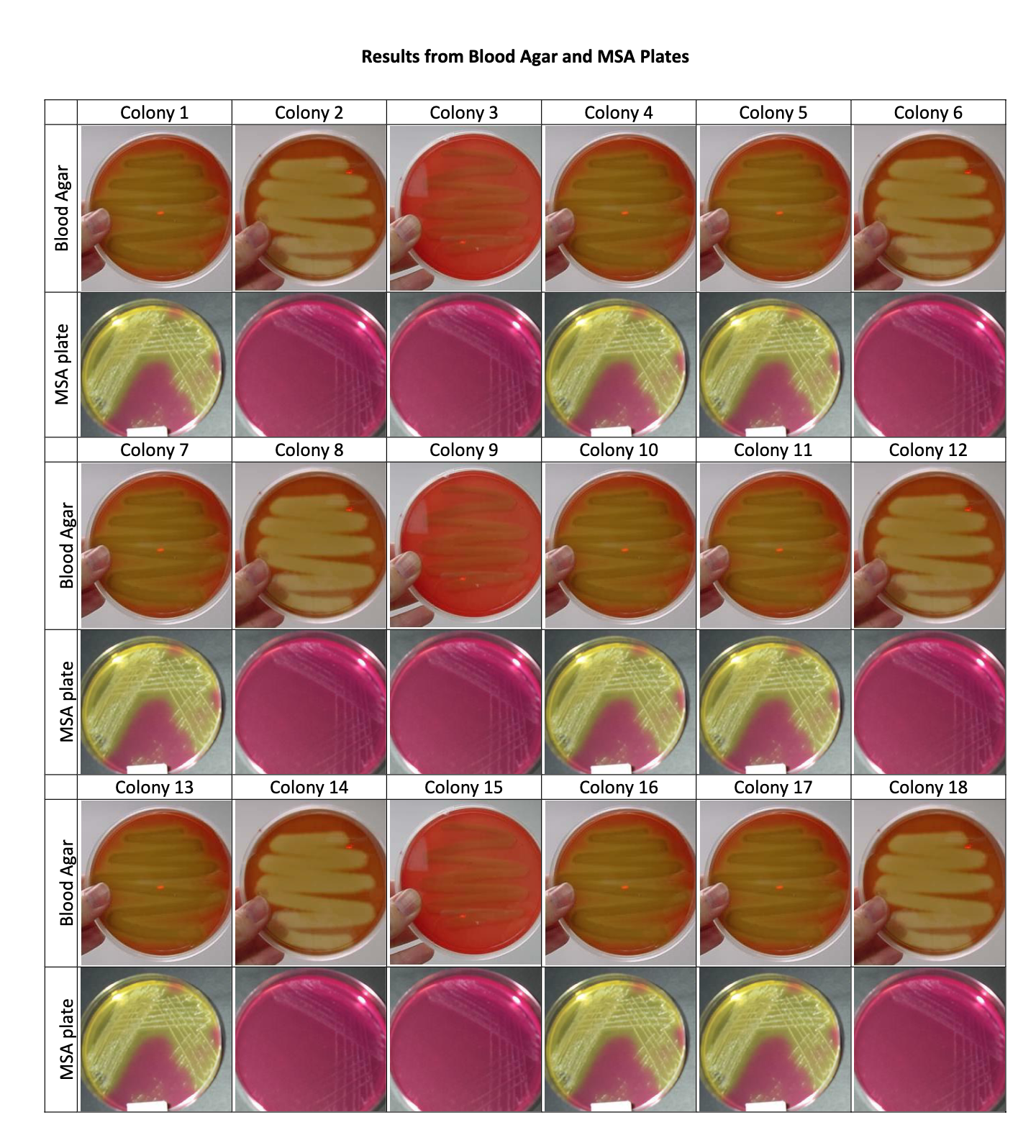 Results from Blood Agar and MSA Plates Results | Chegg.com