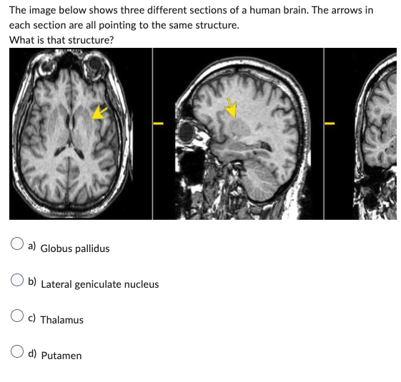 Solved The image below shows three different sections of a | Chegg.com