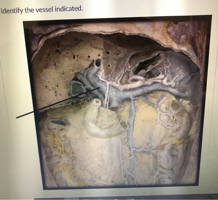 Solved Identify the vessel indicated. Identify the vessel | Chegg.com