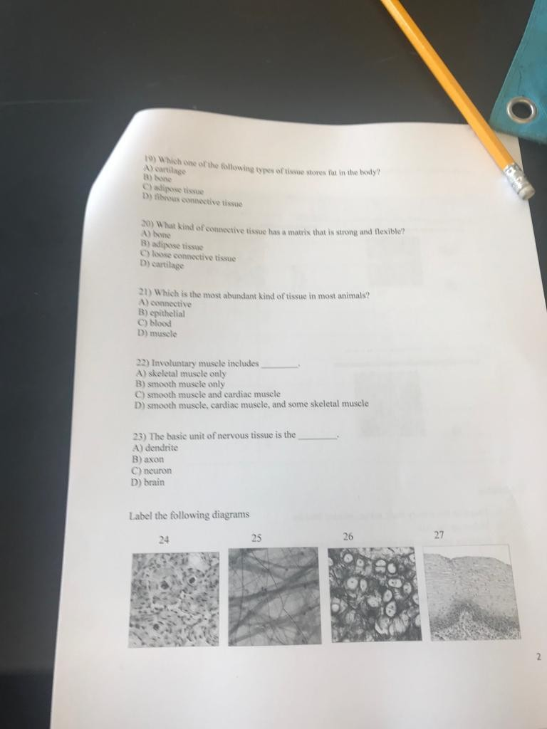 Solved Spring 2019 MIC hiol 201 Quia #2 Matching a columnar | Chegg.com