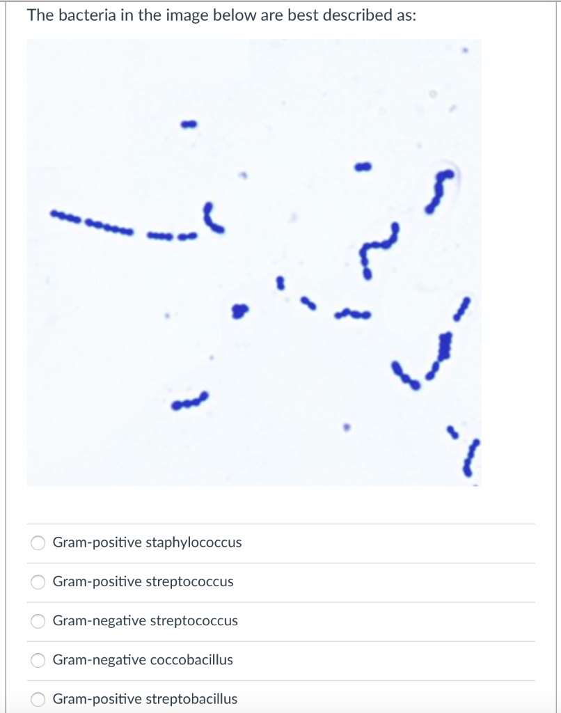 Solved The correct description of the species of bacteria in | Chegg.com