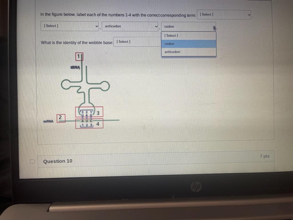 Solved Question 9 In the figure below, label each of the | Chegg.com