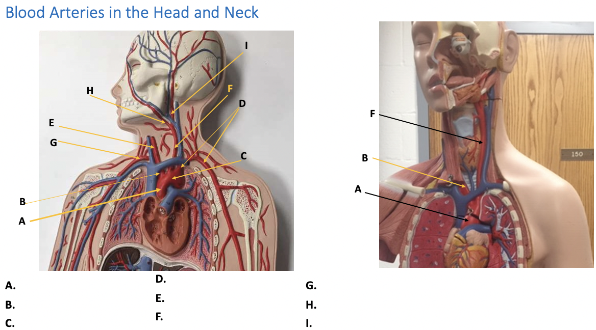 Solved Blood Arteries in the Head and Neck | Chegg.com