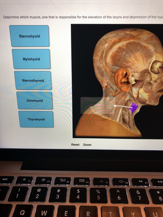 Solved Which structure is highlighted? O buccinator O | Chegg.com