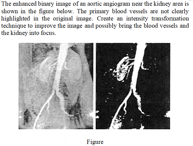 Solved The enhanced binary image of an aortic angiogram near | Chegg.com